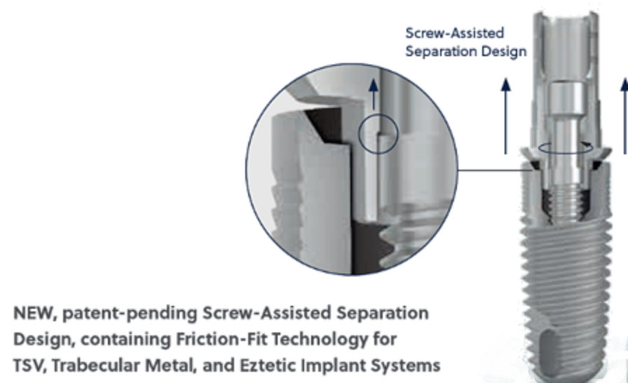 GenTek™ Angulated Screw Channel ti-bases - diverse cuff hoogtes ...